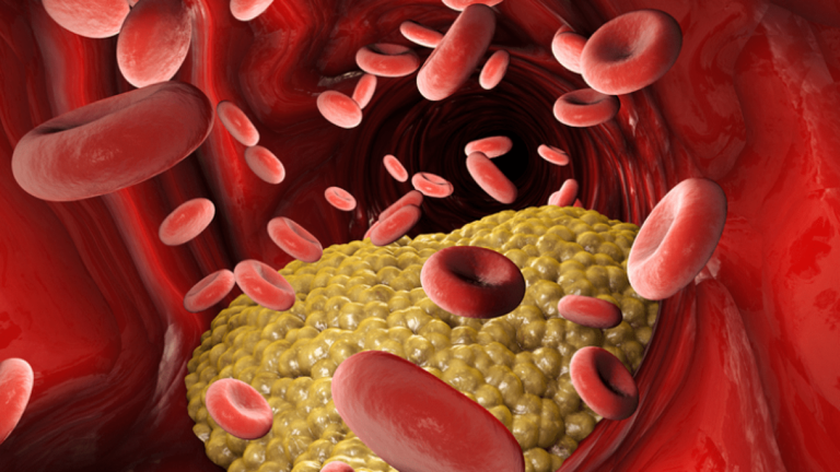 Types of Cholesterol and Its Effect on Your Health.. Everything You ...