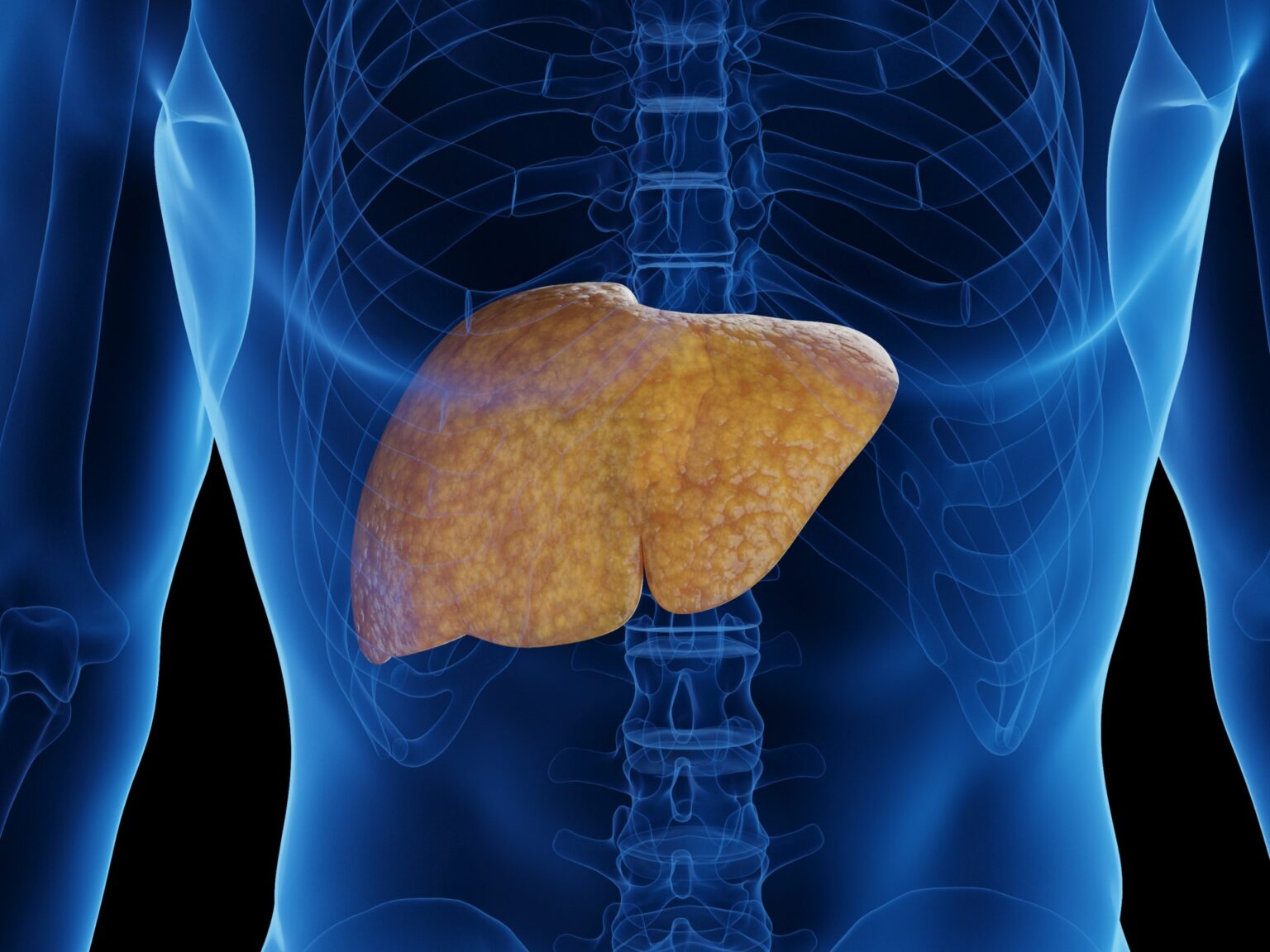 Oily liver disease .. What is it and how is it treated? - Kees