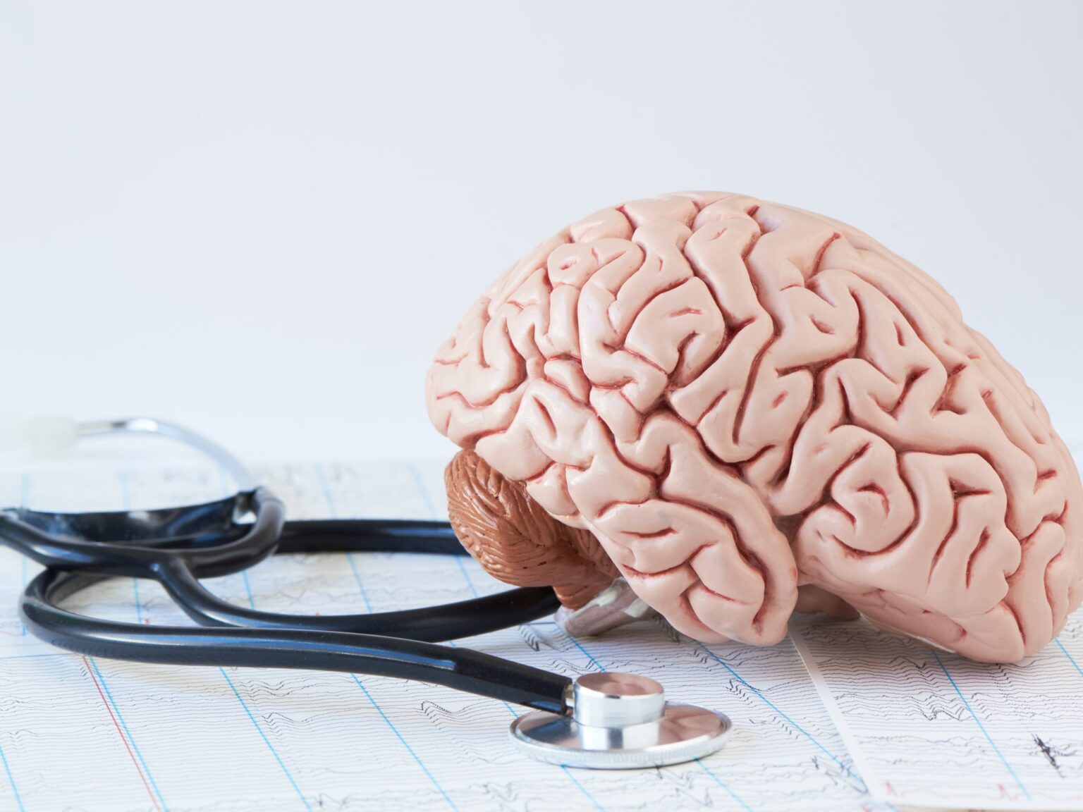A biological indicator that indicates accelerated brain aging - Kees